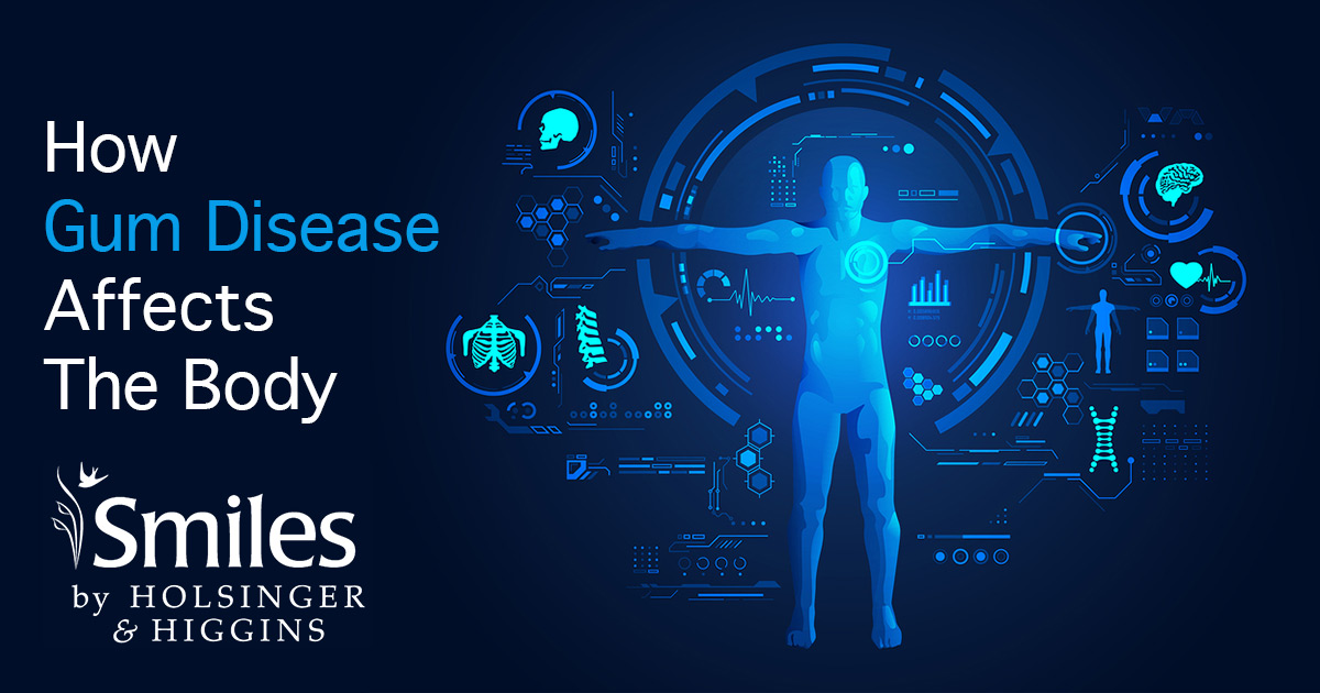 How Gum Disease Affects the Body - Smiles by Holsinger & Higgins